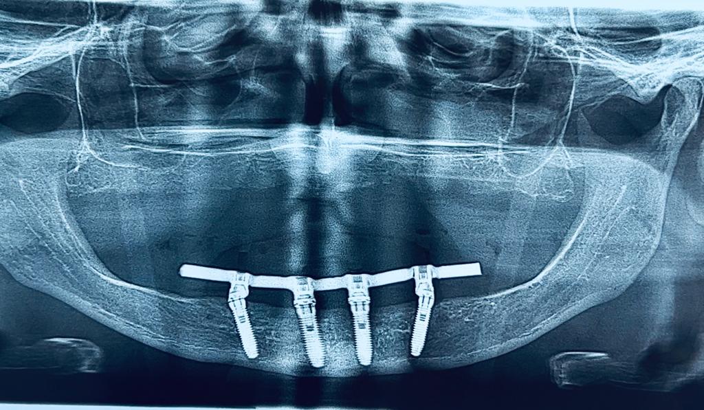 Cirurgias – Saigh Clínica